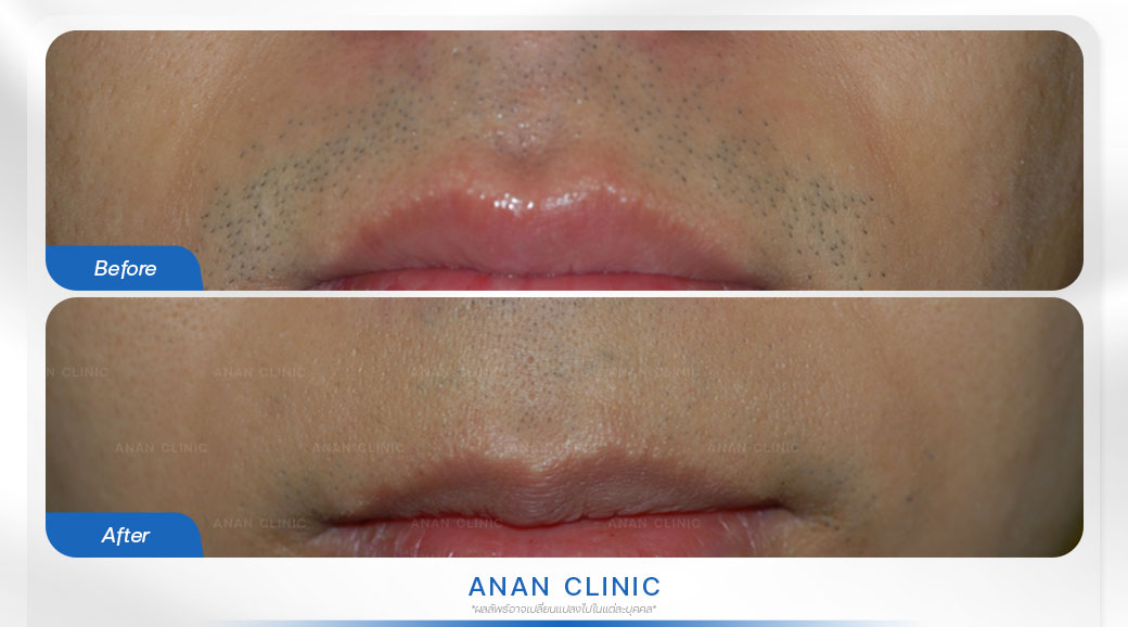 Portfolio – Anan Clinic