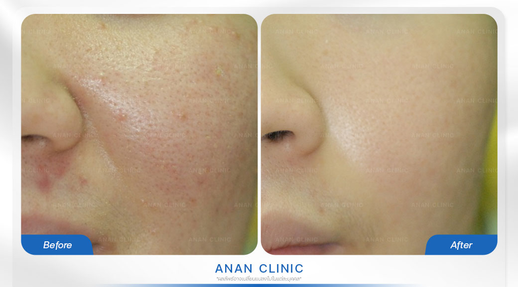 Portfolio – Anan Clinic