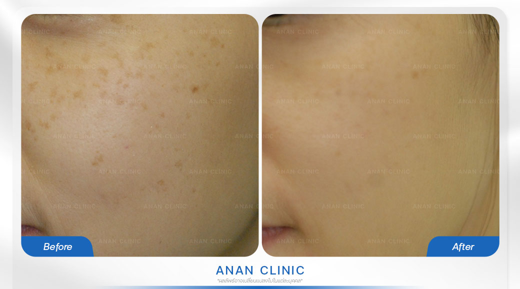 Portfolio – Anan Clinic