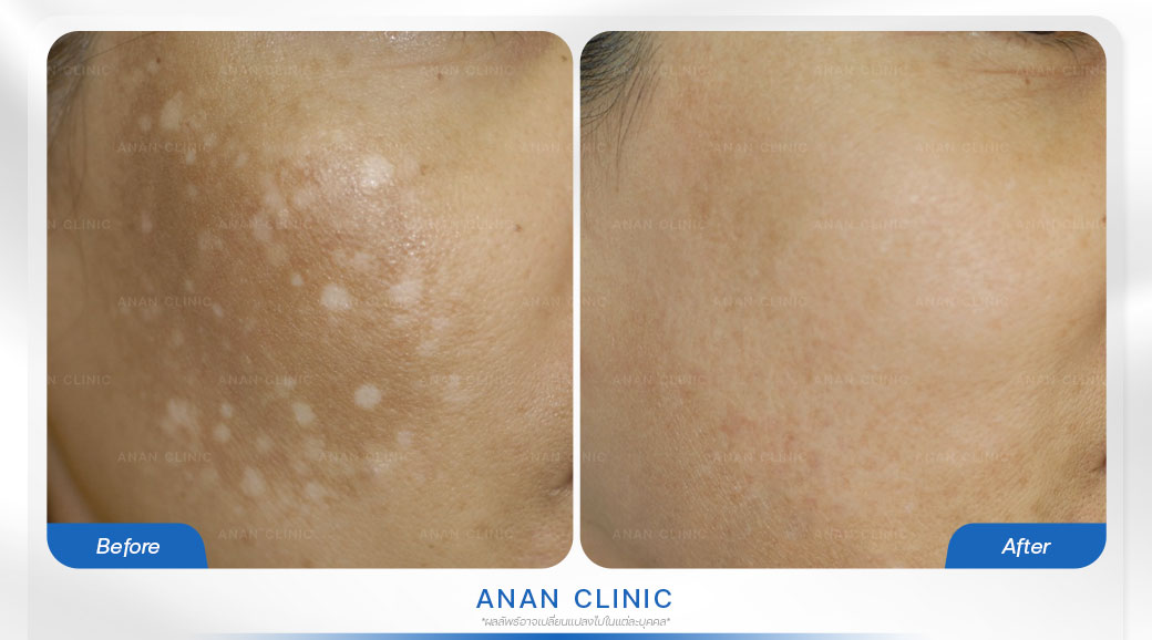 Portfolio – Anan Clinic