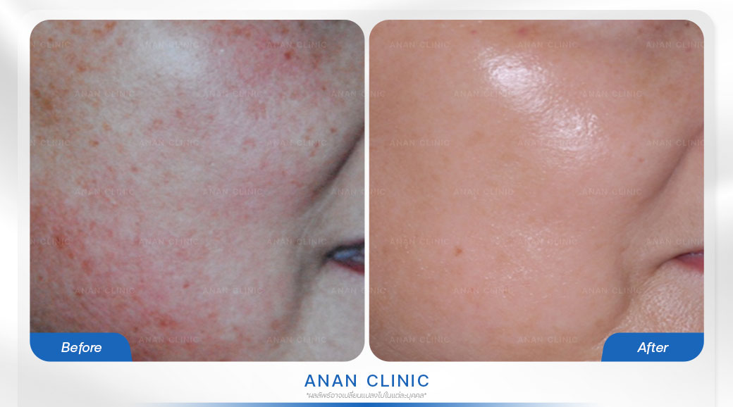 Portfolio – Anan Clinic