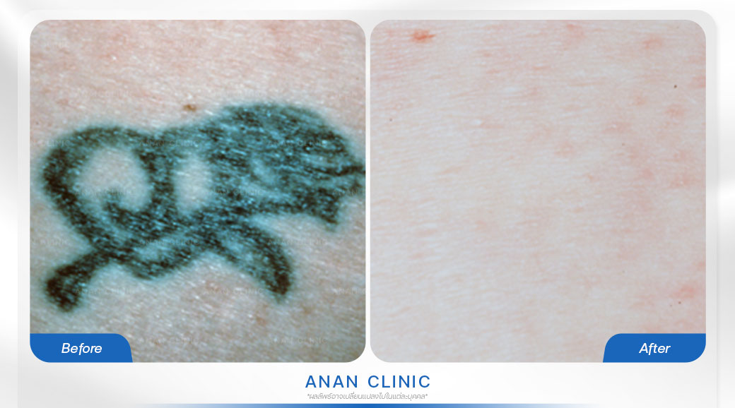 Portfolio – Anan Clinic